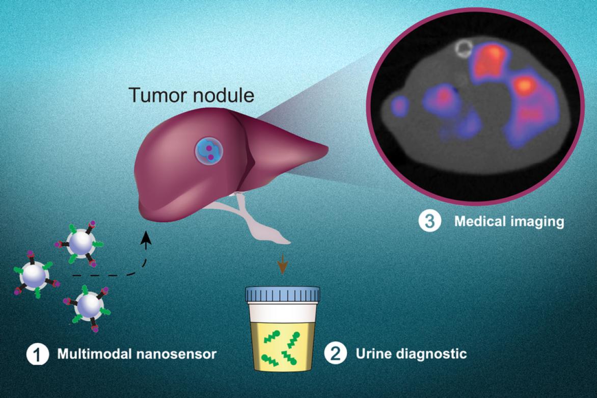 A noninvasive test to detect cancer cells and pinpoint their location ...
