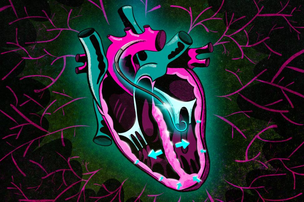 A new test could predict how heart attack patients will respond to ...