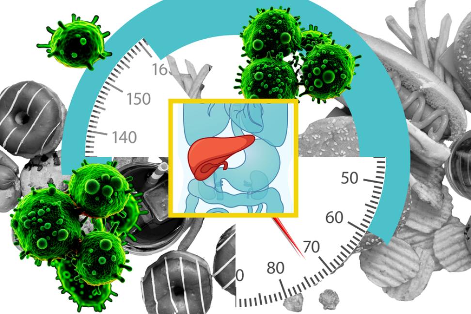 Study: High-fat diets make liver cells more likely to become cancerous ...