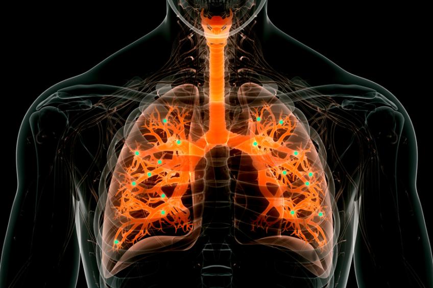 New nanoparticles can perform gene editing in the lungs | Harvard-MIT ...